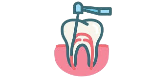 Root Canal Treatment with CBCT Diagnostic Imaging – Smile Life Dental ...